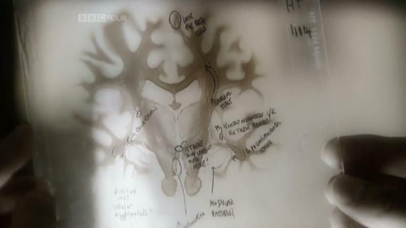 The Brain — A Secret History – Thought Maybe